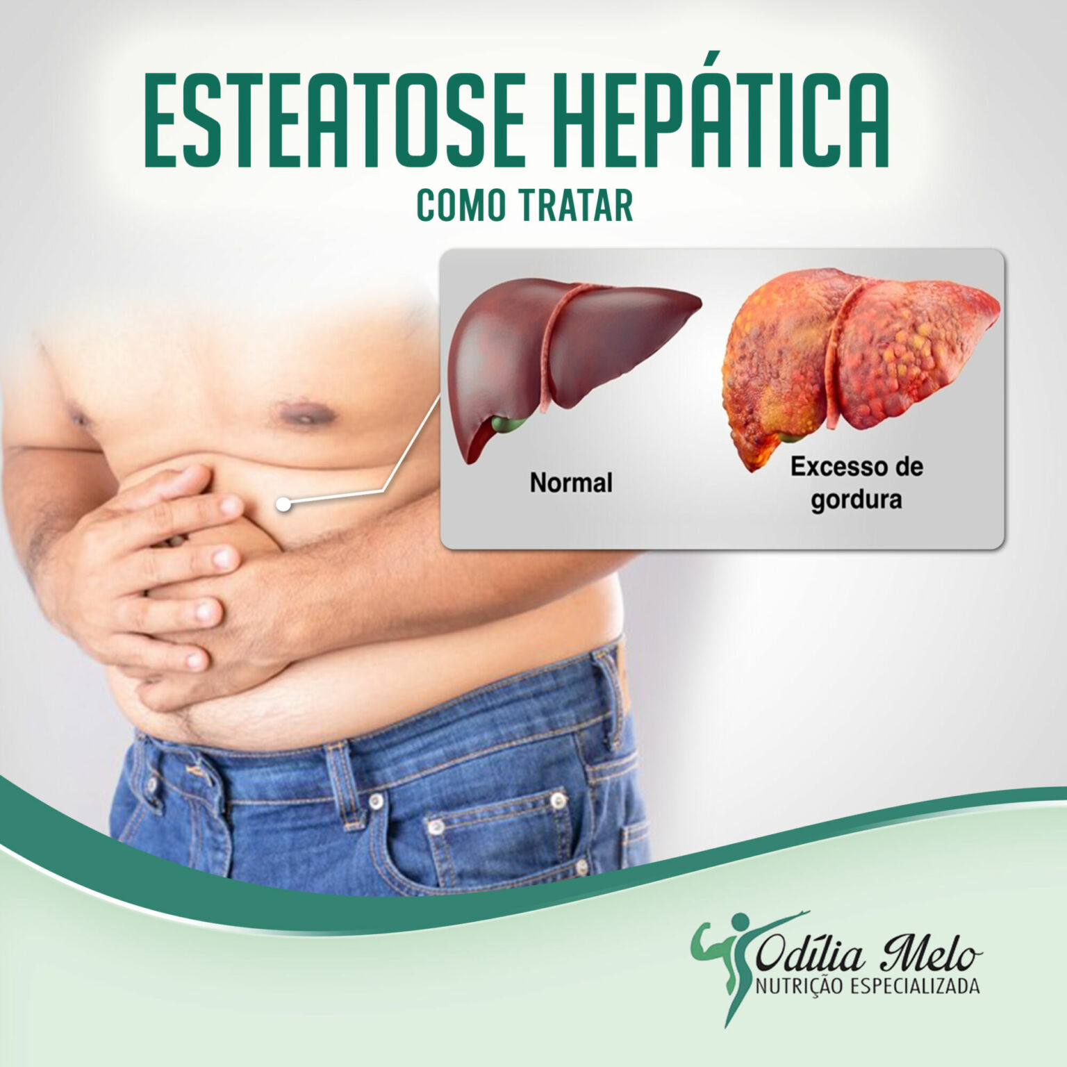 Esteatose Hepática Grau 4 Tem Cura - RETOEDU